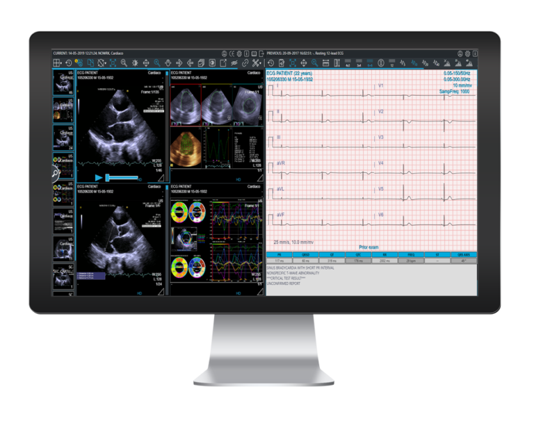 Universal Viewer - L.spot
