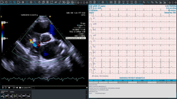 Universal Viewer - L.spot